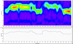 ClockLab Analyses | Actimetrics